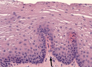 Gastroesophageal Junction Slide Labeled