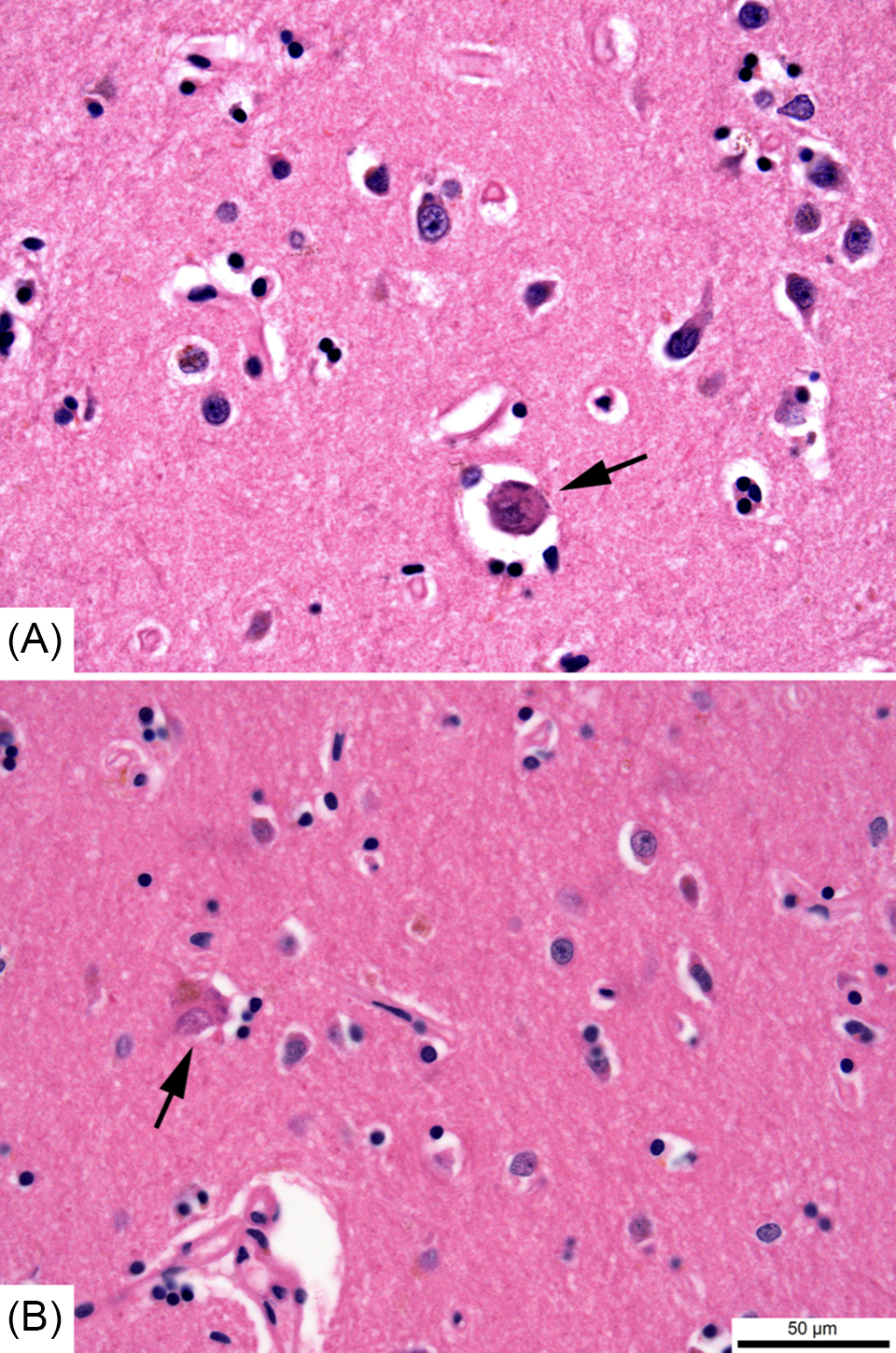 Post-mortem Examination of the Nervous System: Fresh versus Fixed ...