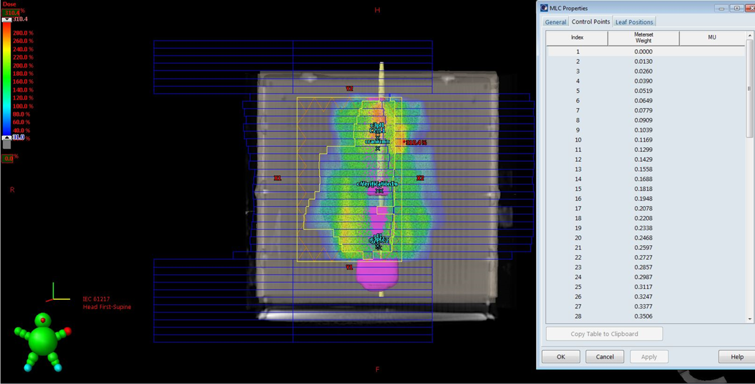 Estimation of monitor unit through analytical method for dynamic IMRT using control points as an ...