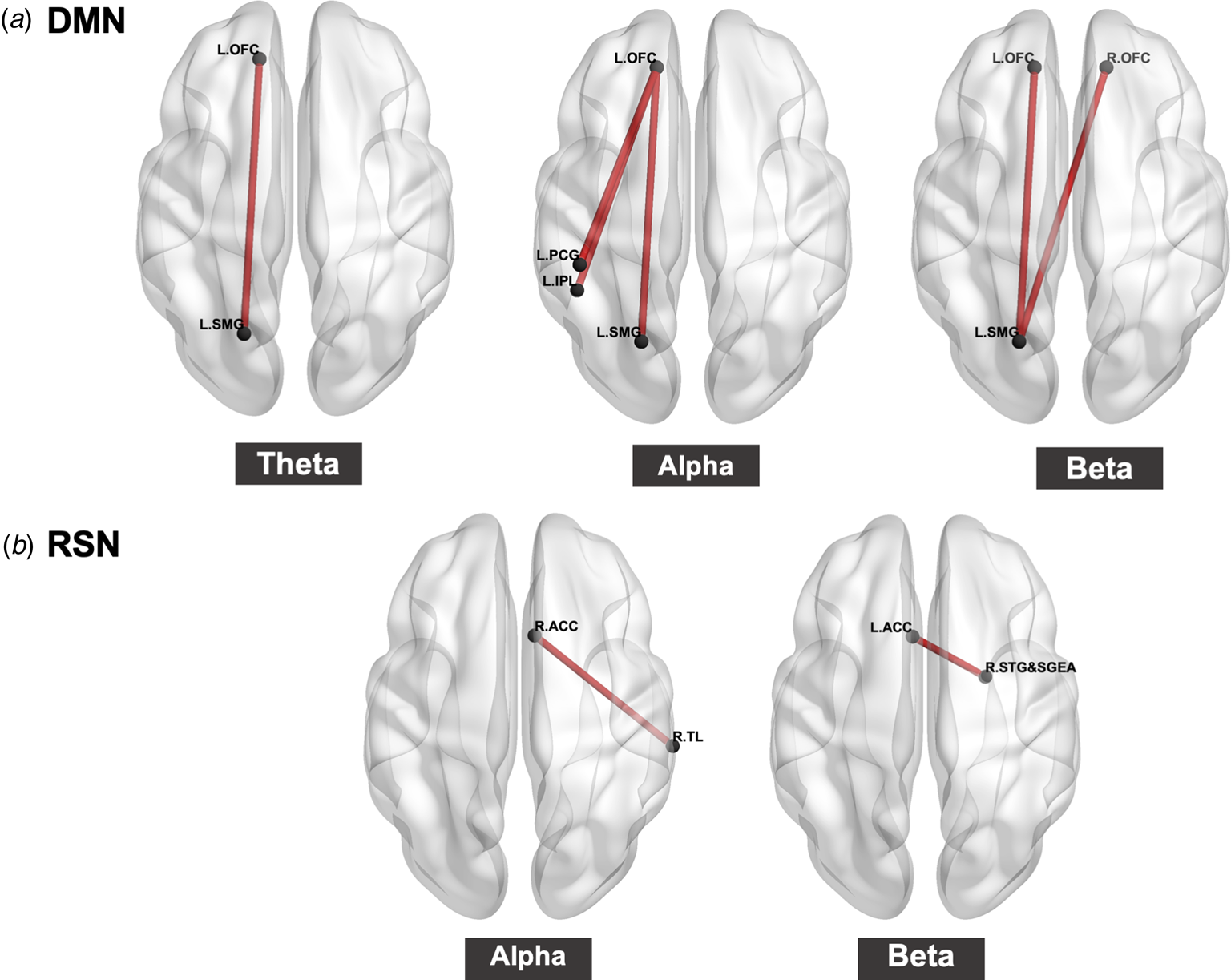 Enhanced resting-state EEG source functional connectivity within the ...