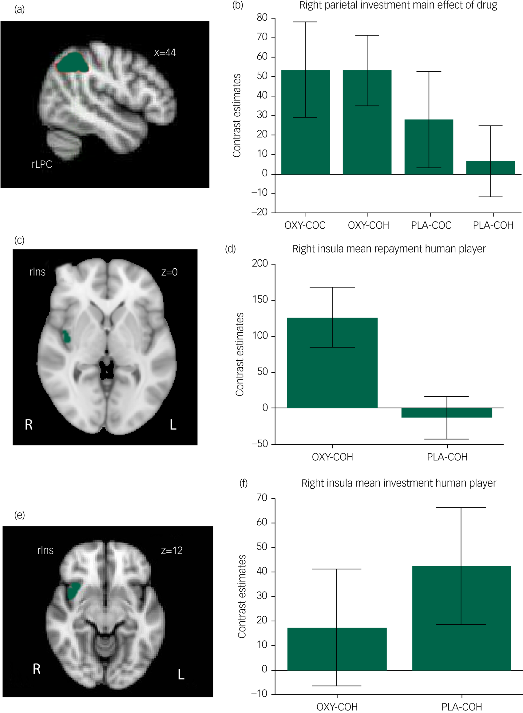 Neuroimaging oxytocin modulation of social reward learning in ...