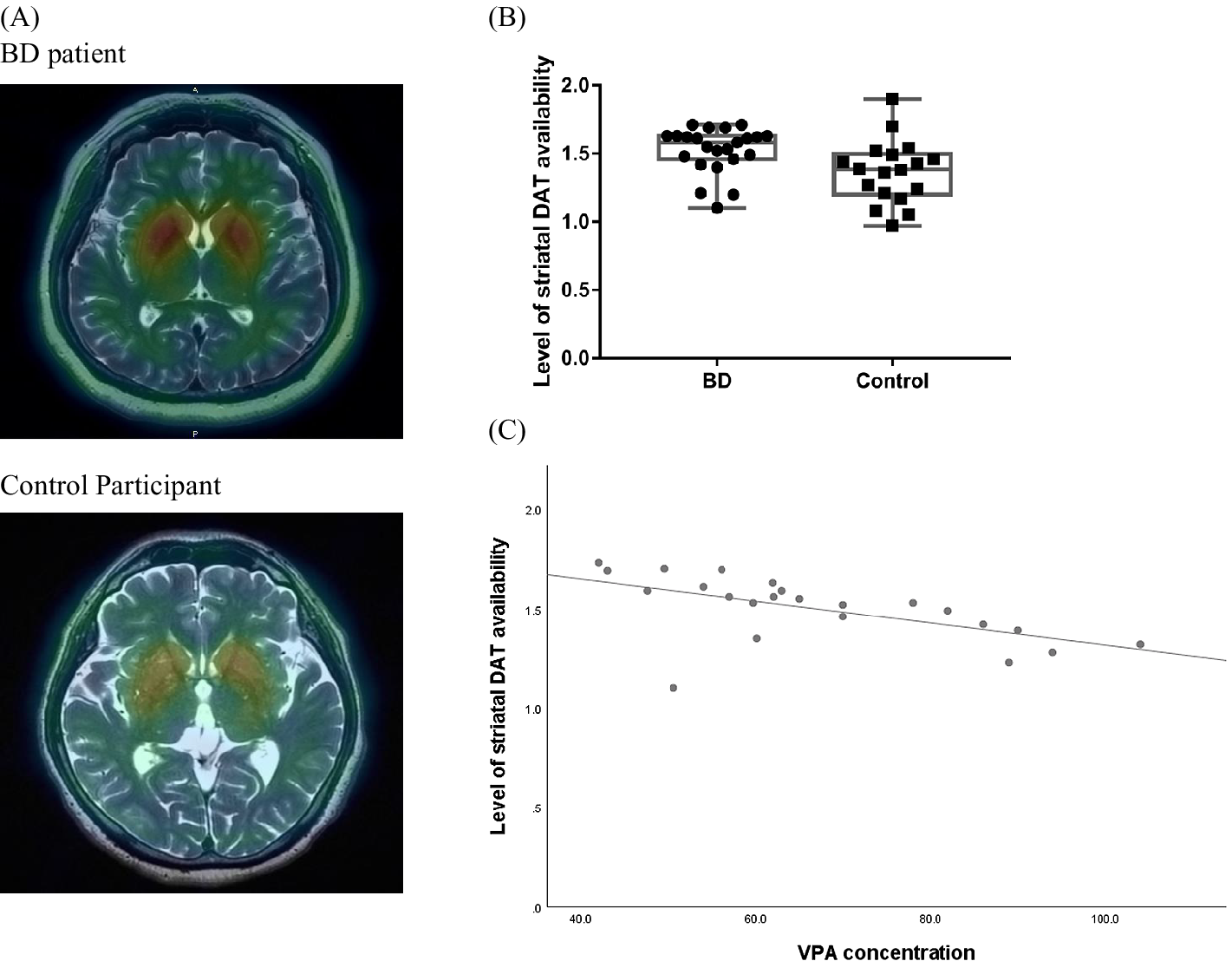 Changes in striatal dopamine transporters in bipolar disorder and ...