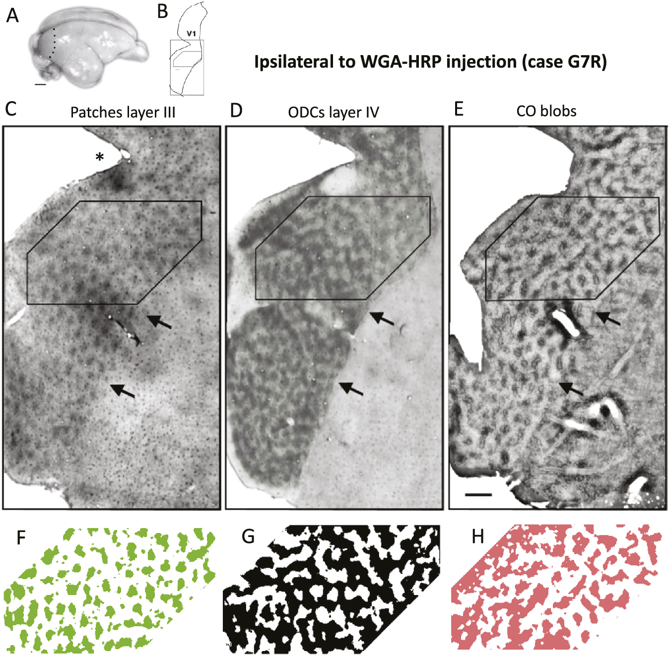 Overall patterns of eye-specific retino-geniculo-cortical projections to layers III, IV, and VI ...