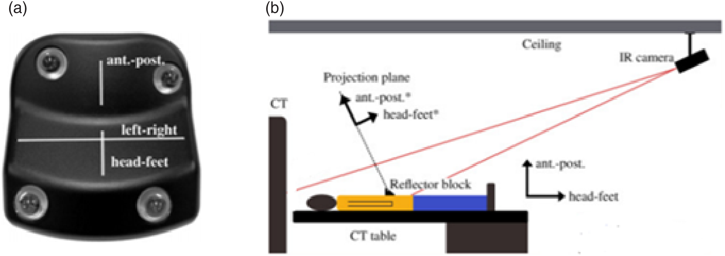 Respiratory gating in patients with lung carcinoma undergoing ...