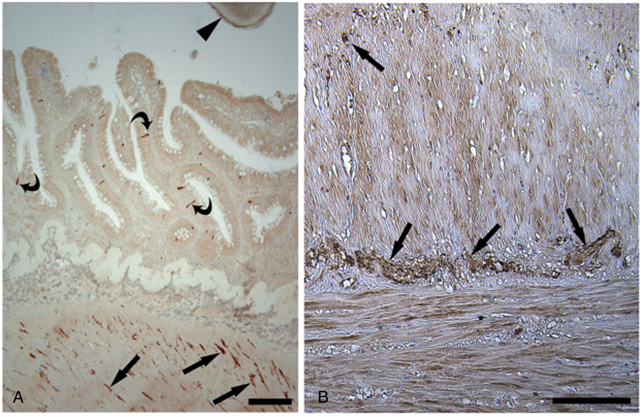 Parasites and the neuroendocrine control of fish intestinal function ...