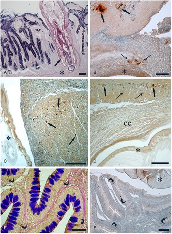 Parasites and the neuroendocrine control of fish intestinal function ...