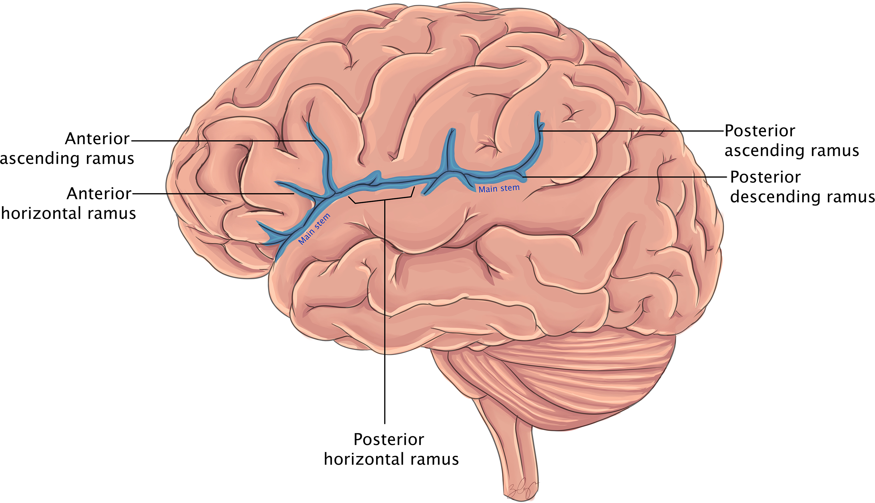 A Review on the Surgical Management of Insular Gliomas | Canadian ...