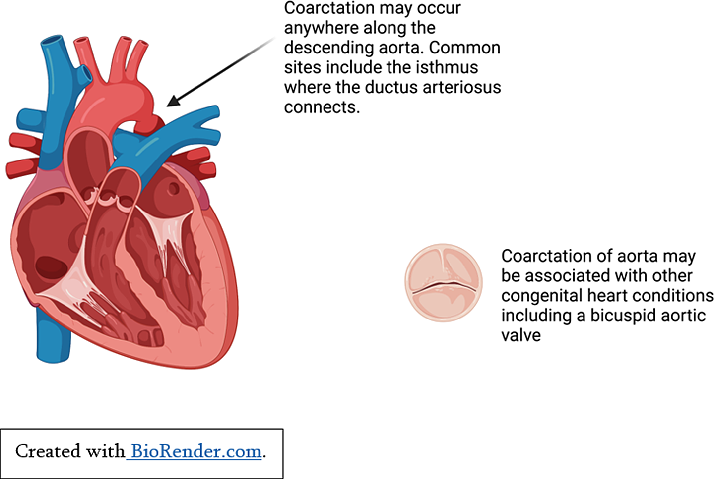 Paediatric heart failure – understanding the pathophysiology and the ...