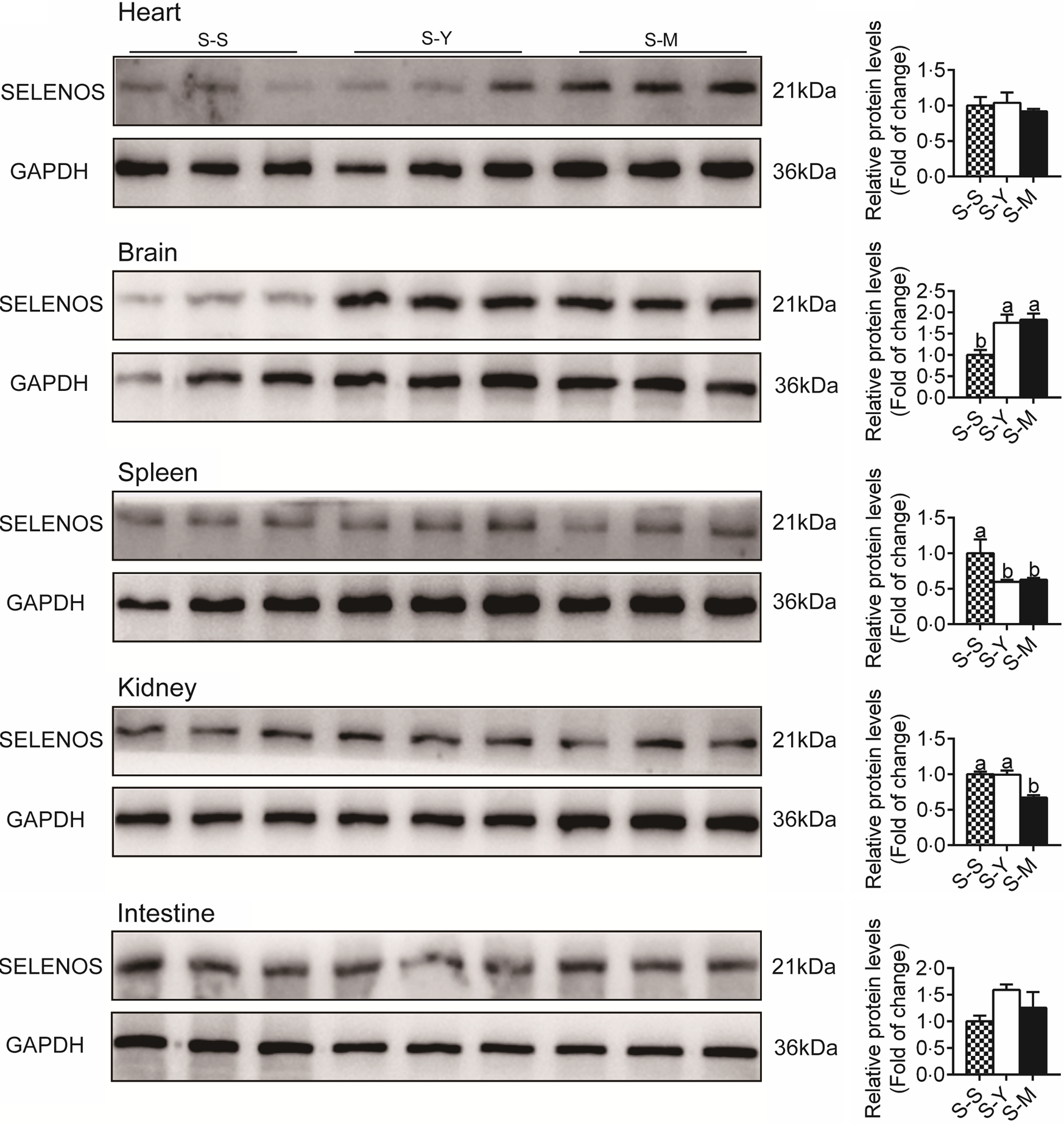 Dietary selenium sources differentially regulate selenium concentration ...