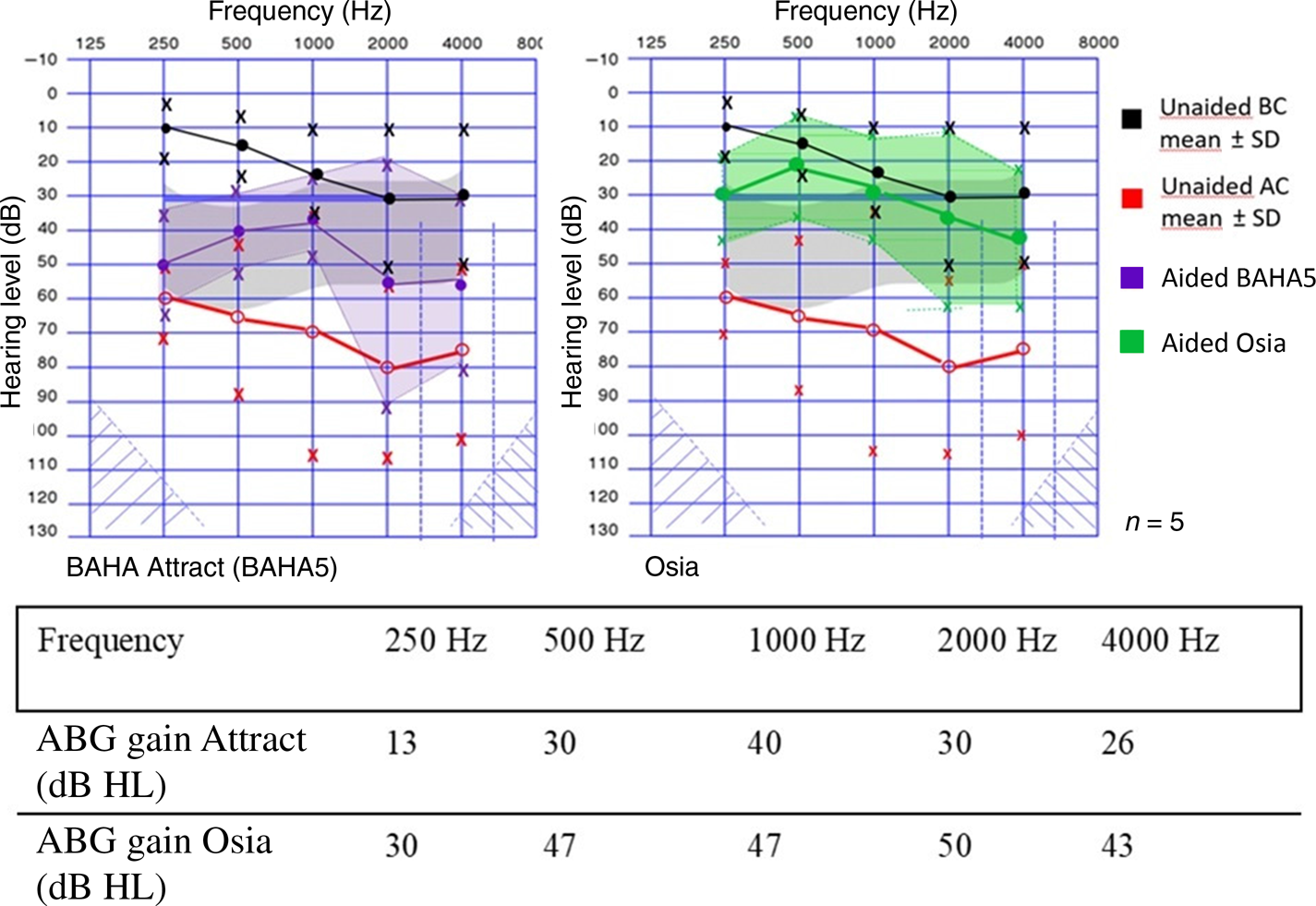 BAHA Attract to Osia conversion patients: comparison of the two systems ...