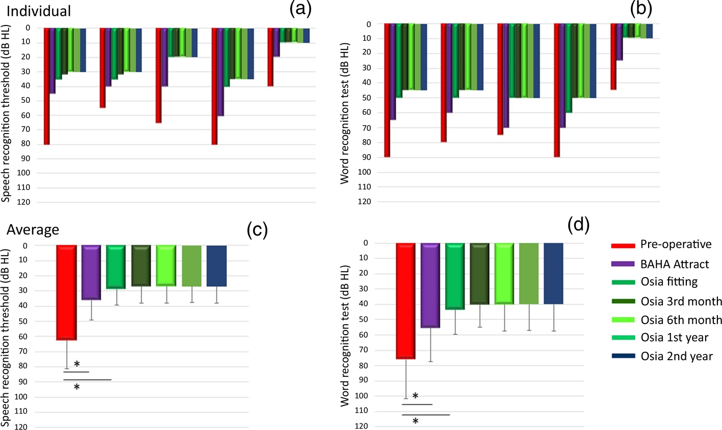 BAHA Attract to Osia conversion patients: comparison of the two systems ...