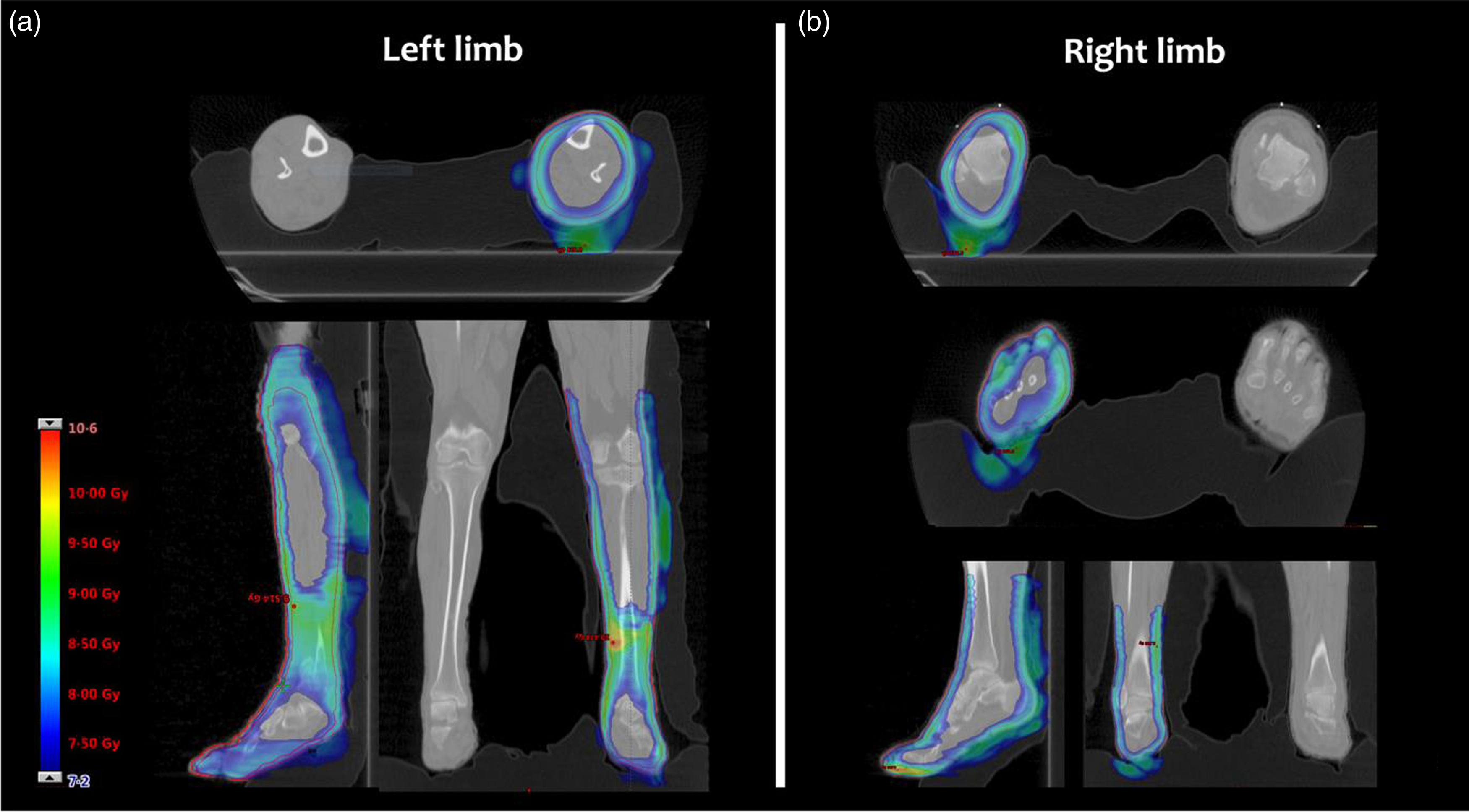 Paraffin gauze bolus as tissue compensator in photon irradiation for ...