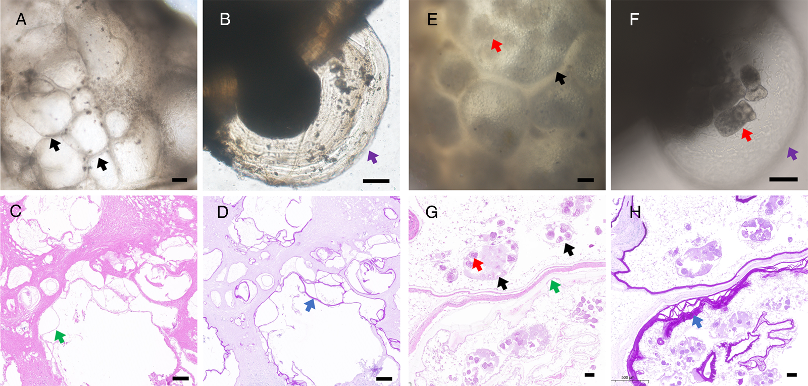 Establishment of a secondary infection laboratory model of Echinococcus ...