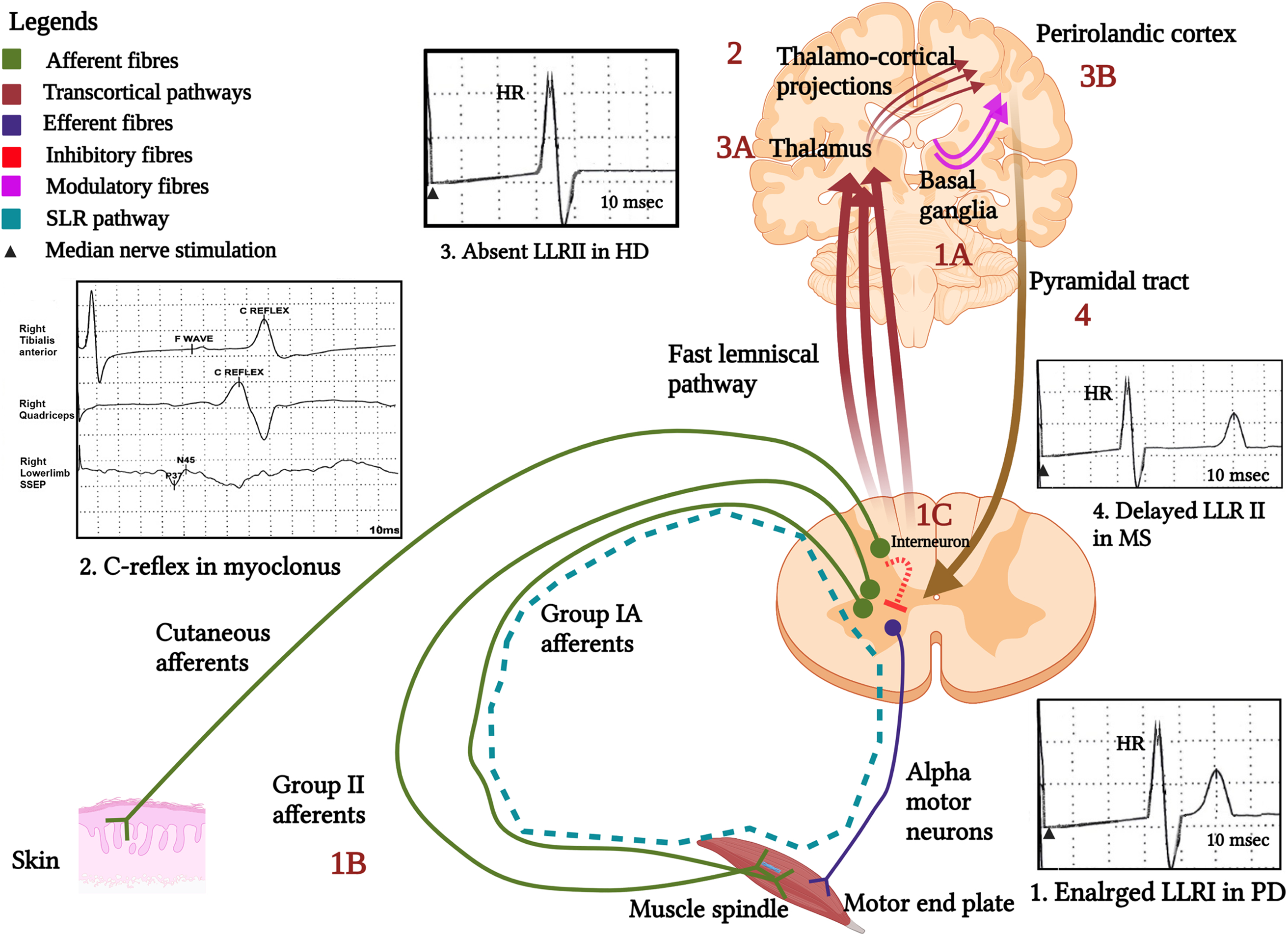 Long Latency Reflexes in Clinical Neurology: A Systematic Review ...