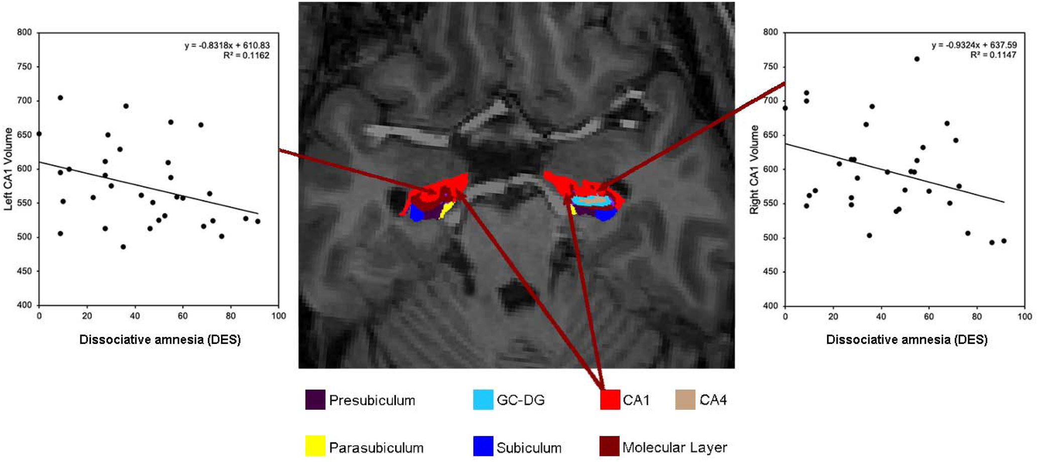 A neurostructural biomarker of dissociative amnesia: a hippocampal ...