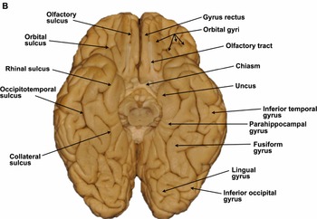 Mesial Temporal Lobe Anatomy