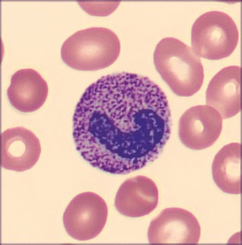 Peripheral Blood Smear Review (Chapter 1) - Atlas of Pediatric ...