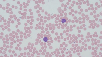 Peripheral Blood Smear Review (Chapter 1) - Atlas of Pediatric ...