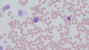 Peripheral Blood Smear Review (Chapter 1) - Atlas of Pediatric ...