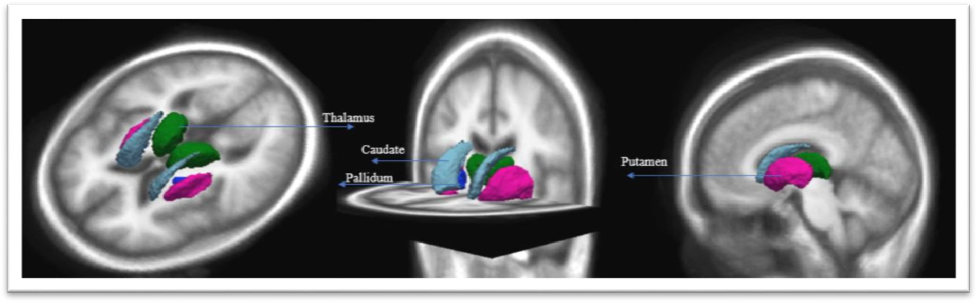 A comparison of structural brain differences in monolingual and highly ...