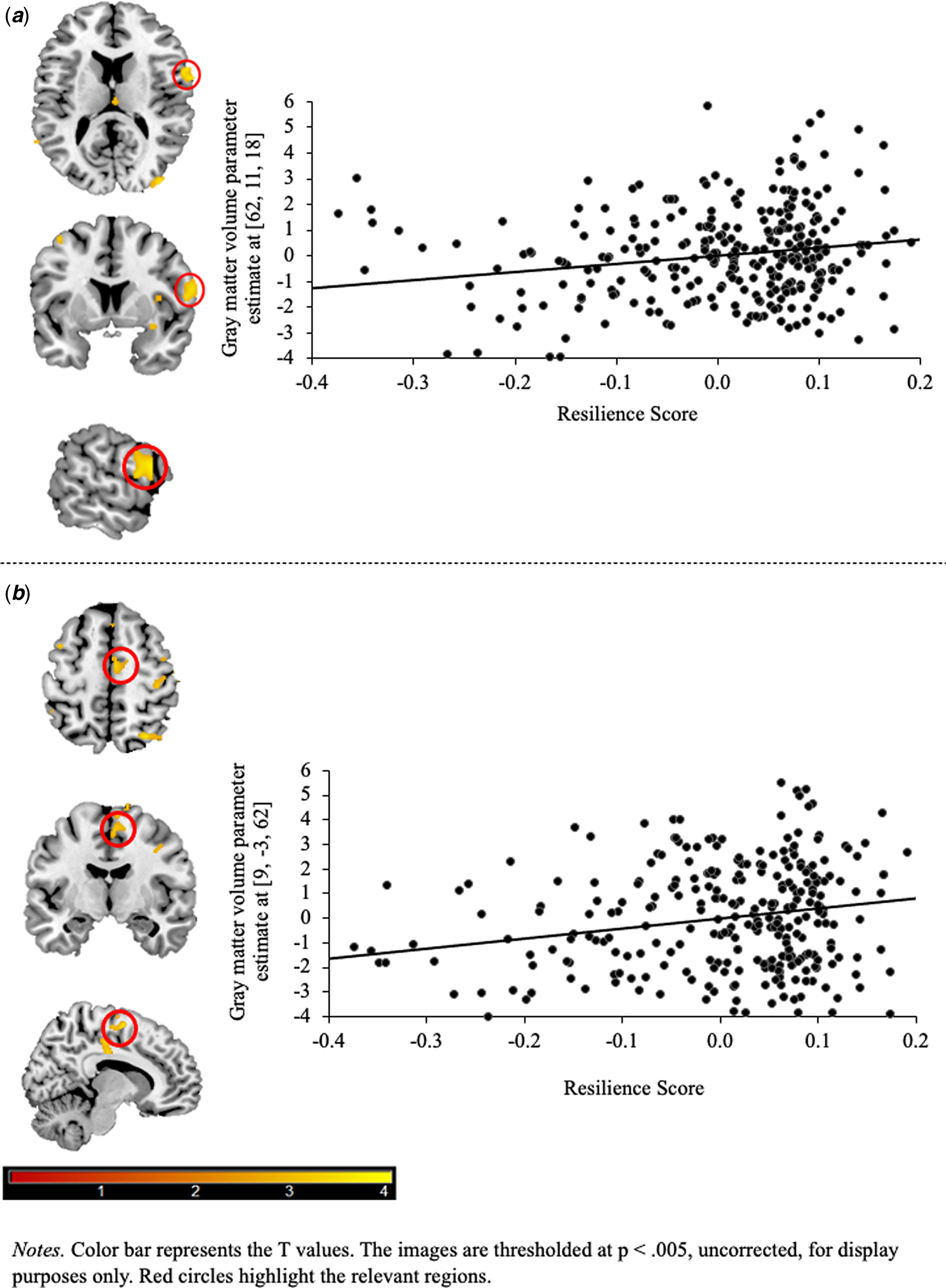 Identifying structural brain markers of resilience to adversity in young people using voxel ...