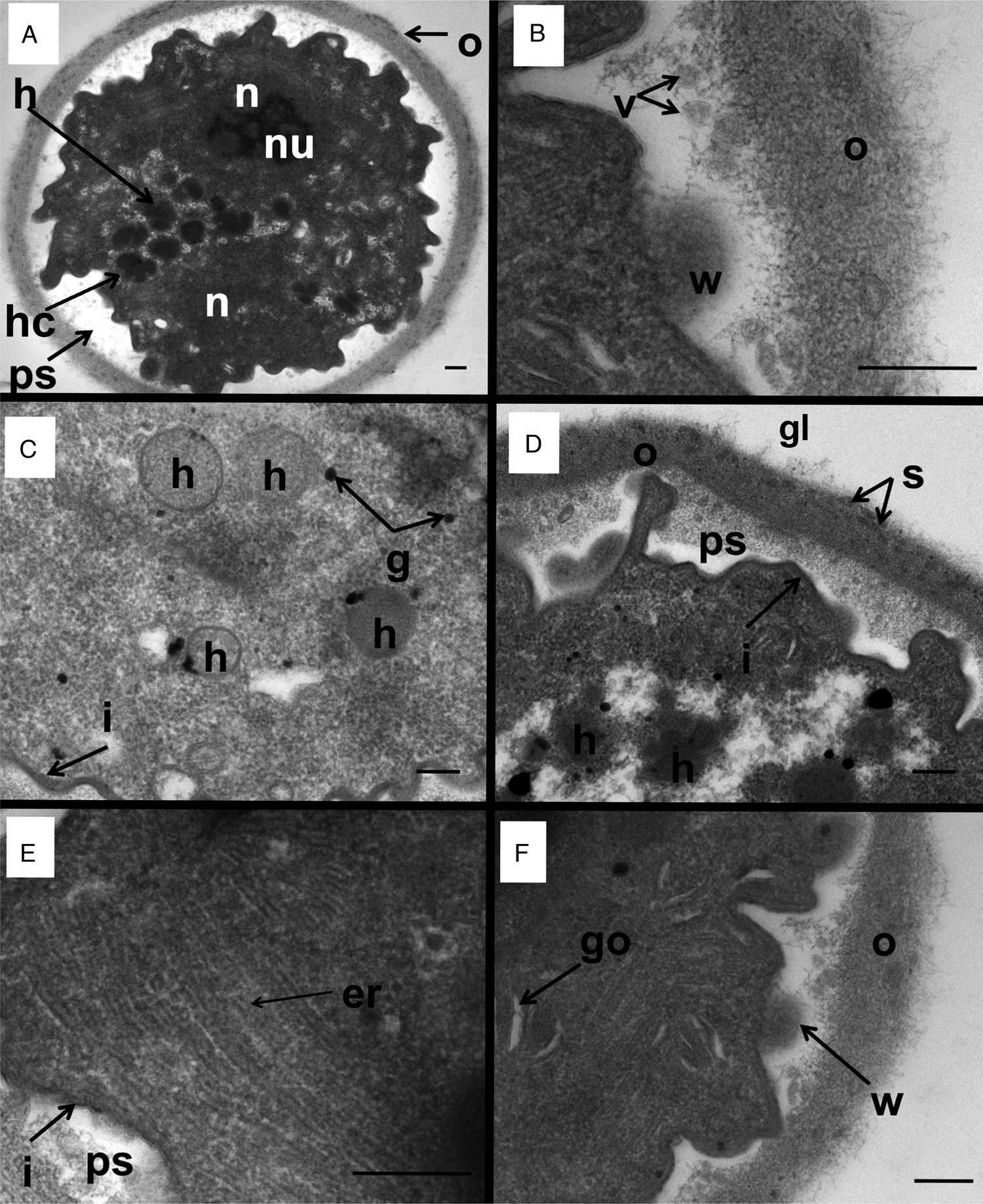 Observations on the transmission of Dientamoeba fragilis and the cyst ...
