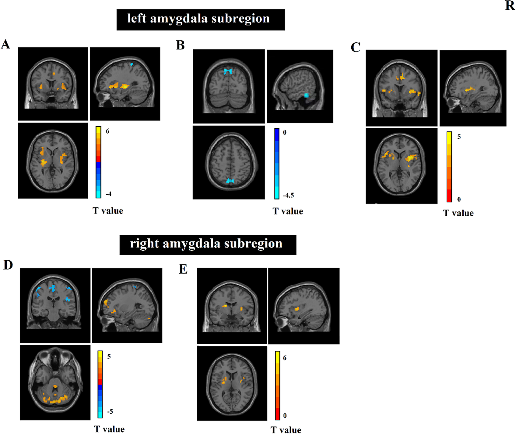 Functional connectivity of the amygdala subregions and the ...