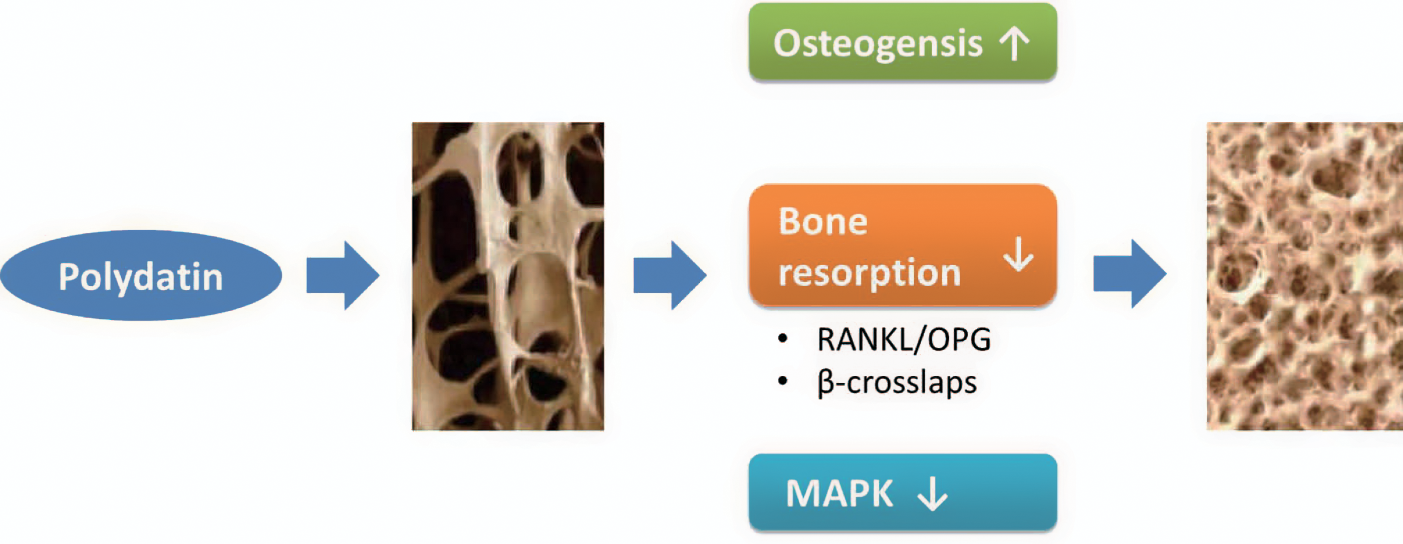 Protective effects of polydatin against bone and joint disorders: the ...