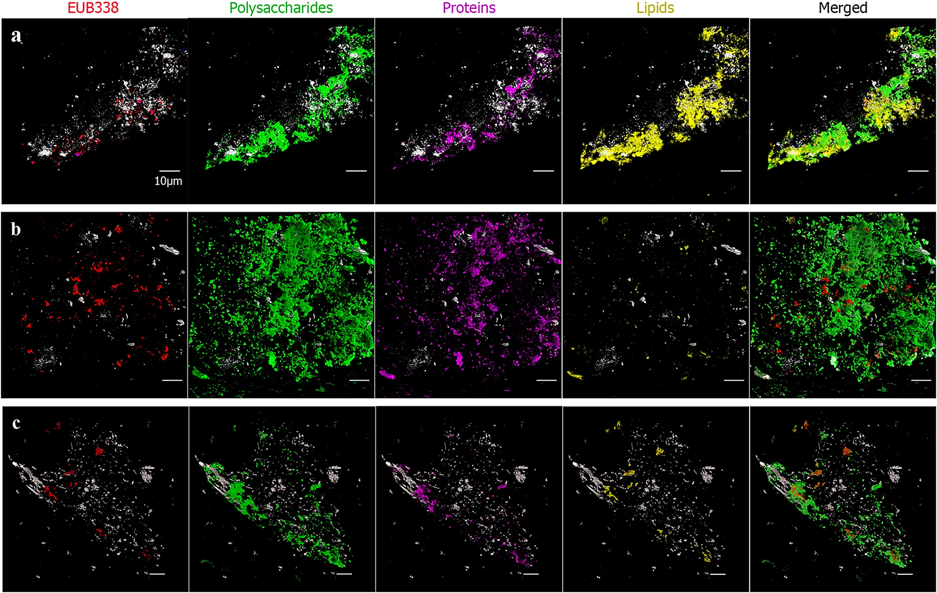 Microbial extracellular polymeric substances (EPS) in soil: From ...