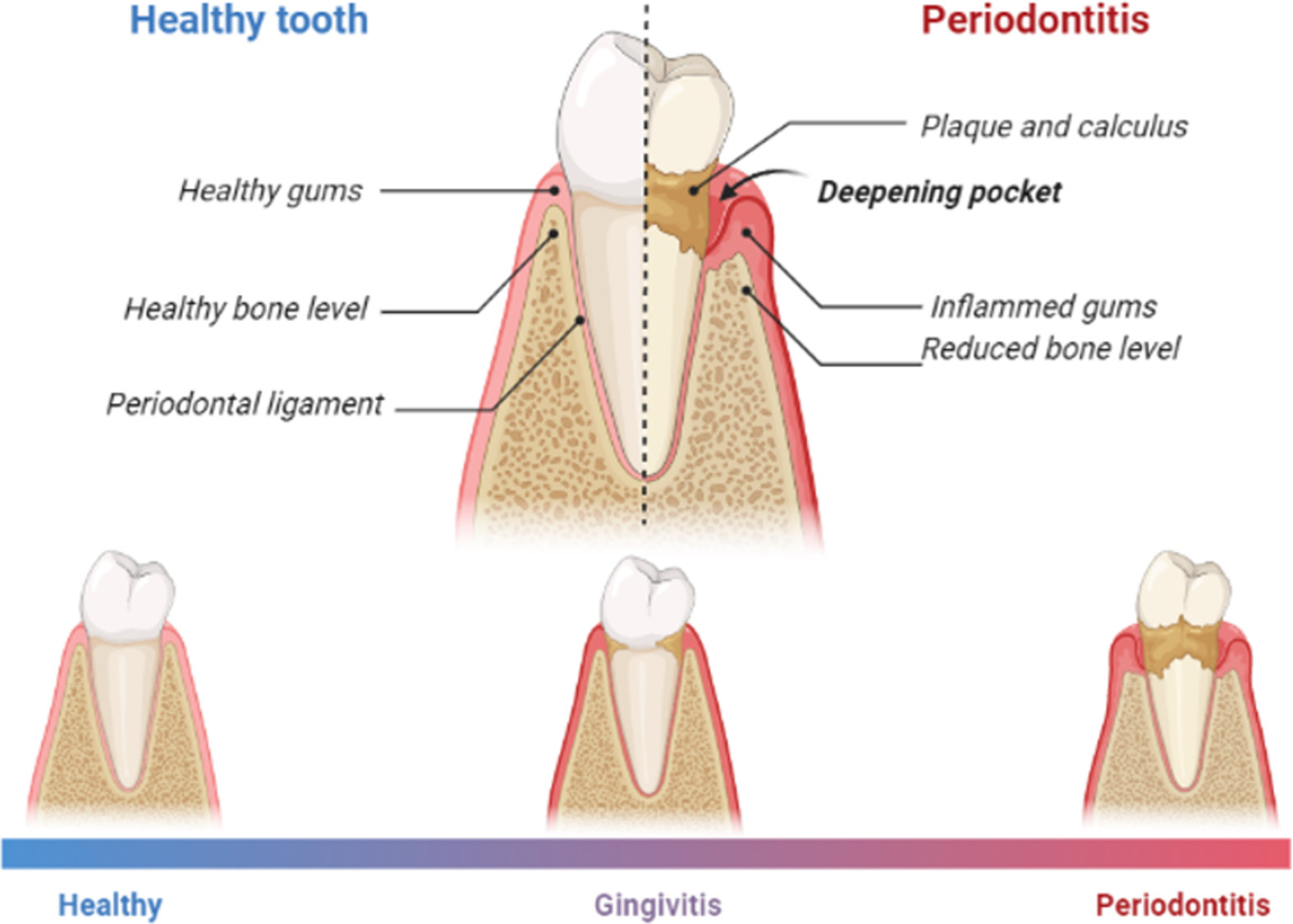 The unrevealed links: periodontal health, human milk composition, and ...