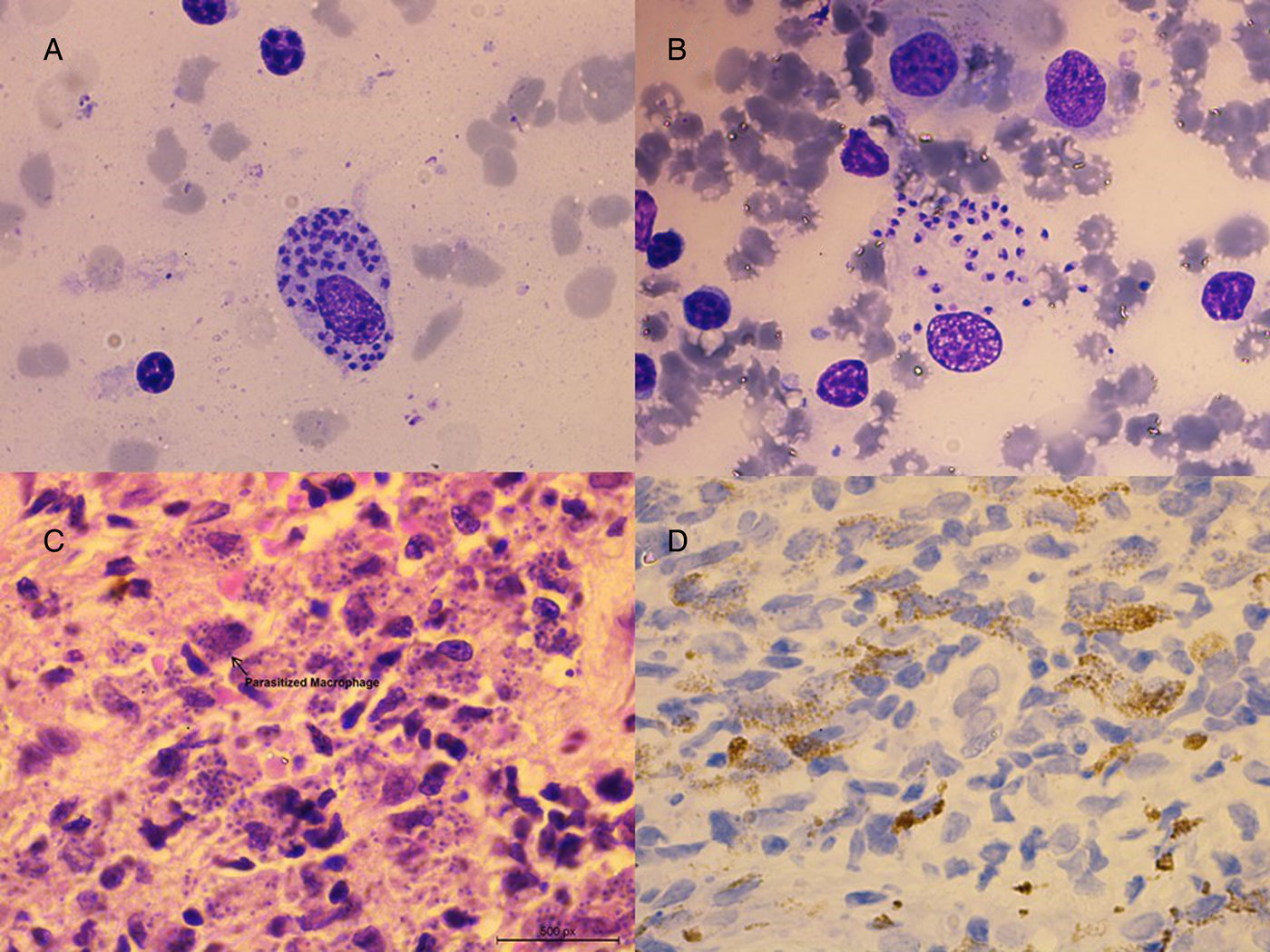 Evaluation Of Cd1a Immunostaining In The Diagnosis Of Cutaneous