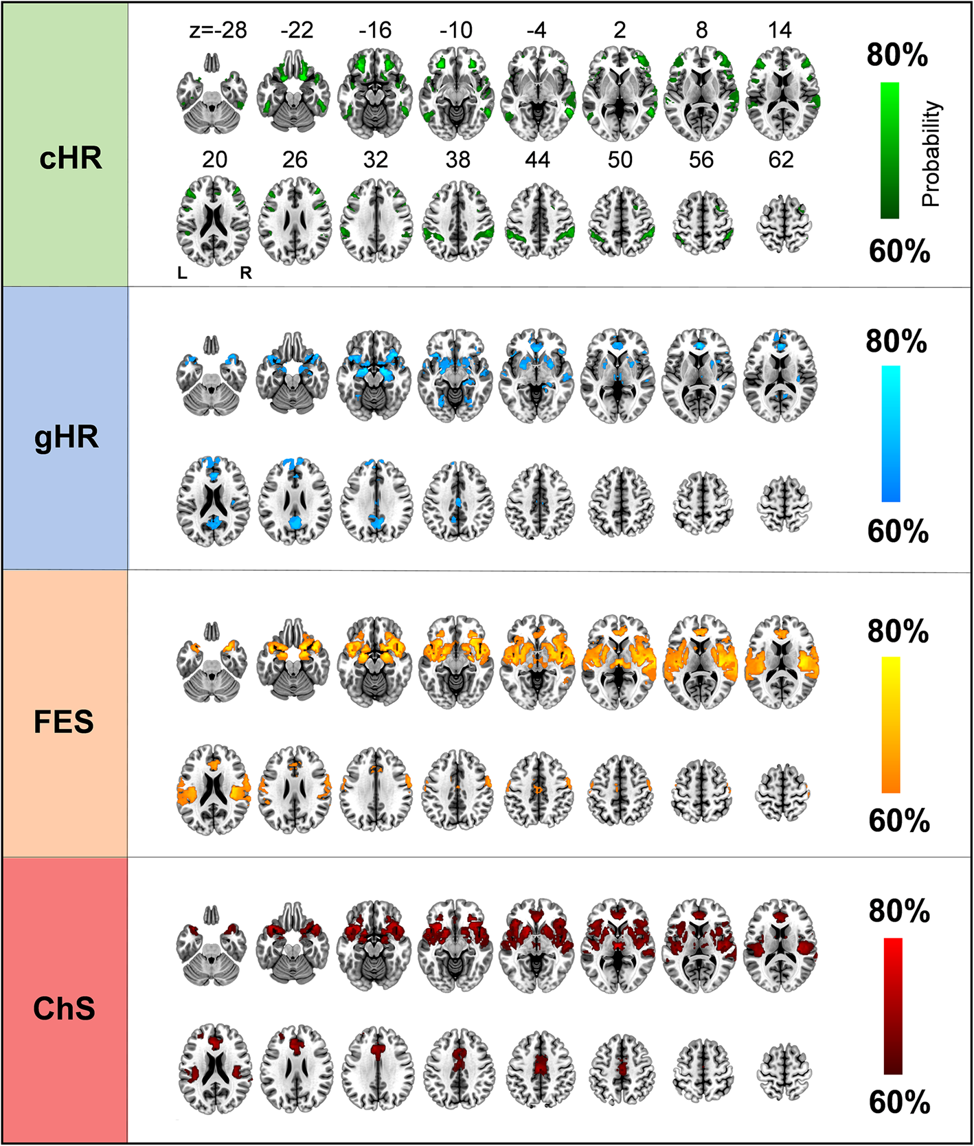 Brain structural damage networks at different stages of schizophrenia ...