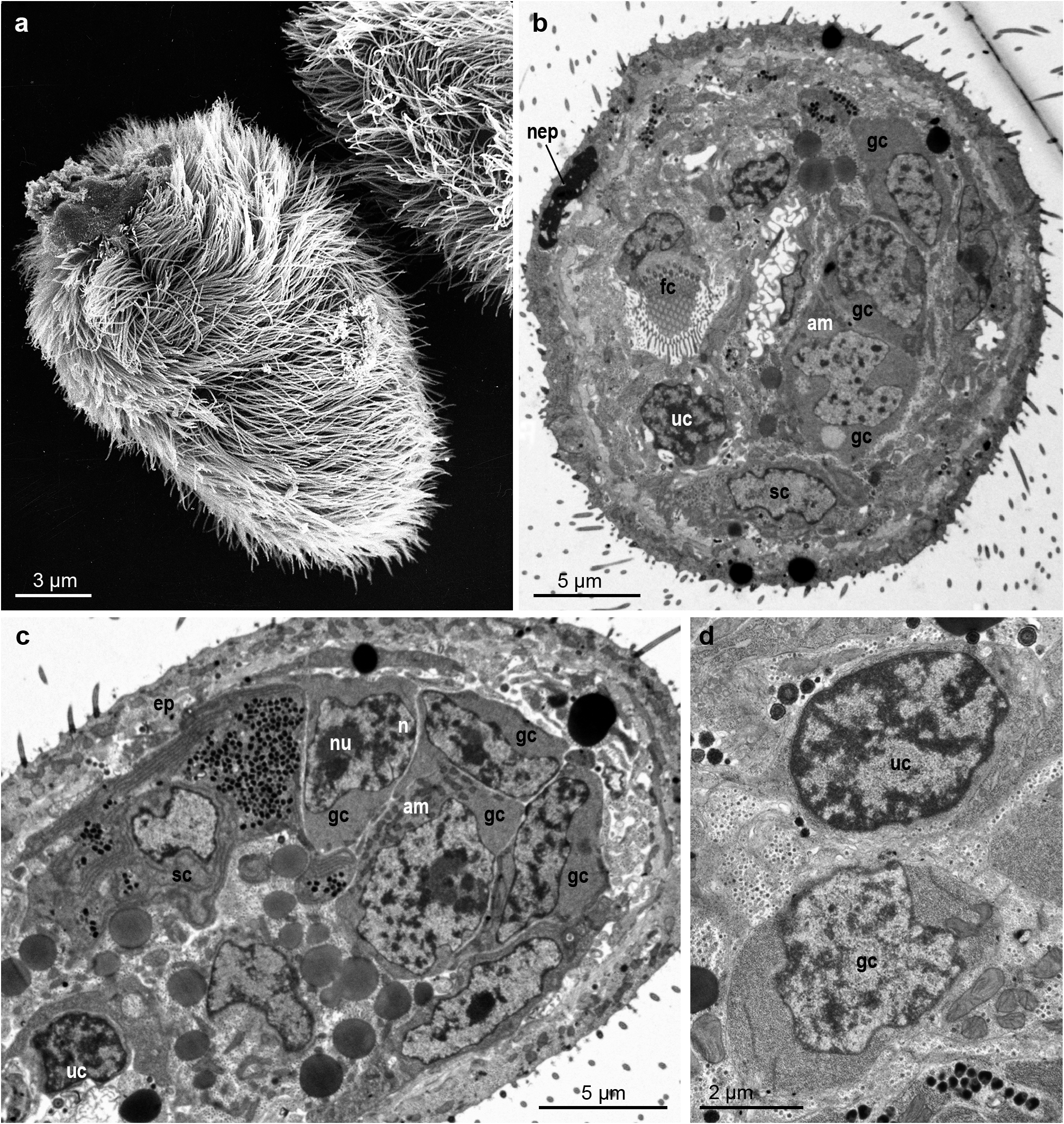 Electron-microscopic analysis of germinal material in mother sporocysts ...