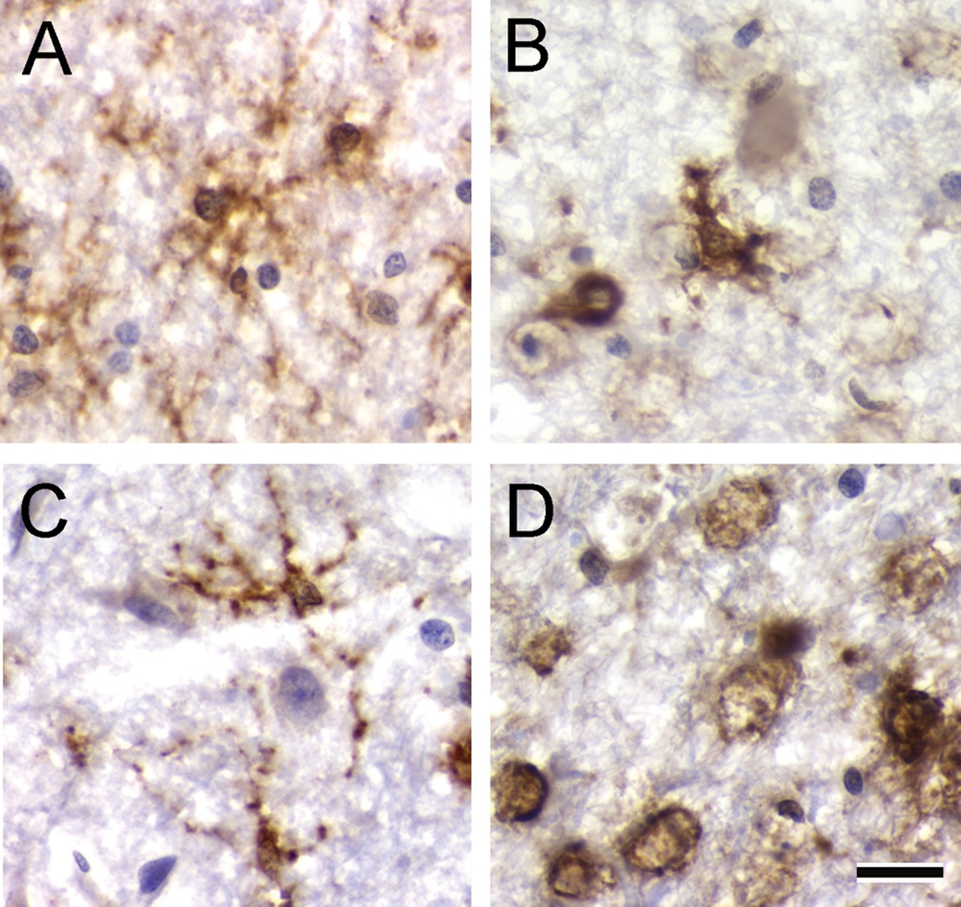NG2-positive glia in the human central nervous system | Neuron Glia ...