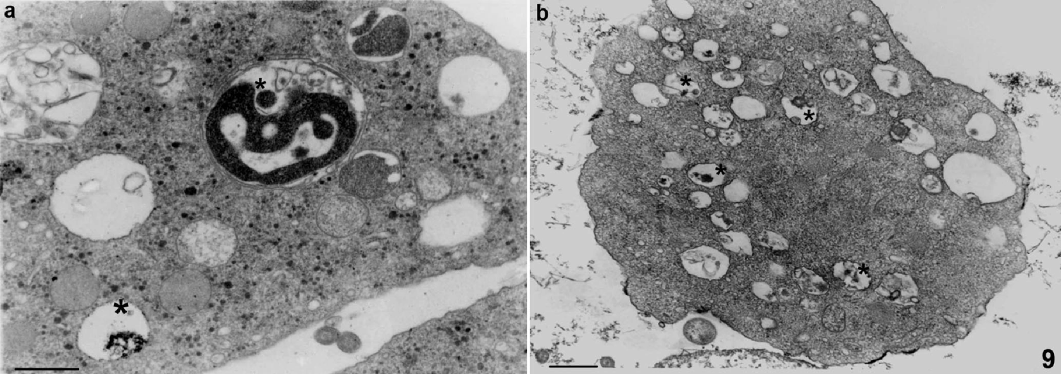 Trichomonas vaginalis kills and eats – evidence for phagocytic activity ...