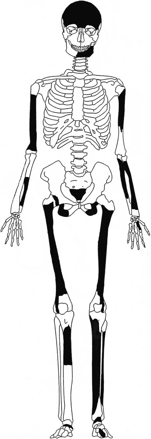 ‘Tilbury Man’: A Mesolithic Skeleton from the Lower Thames ...