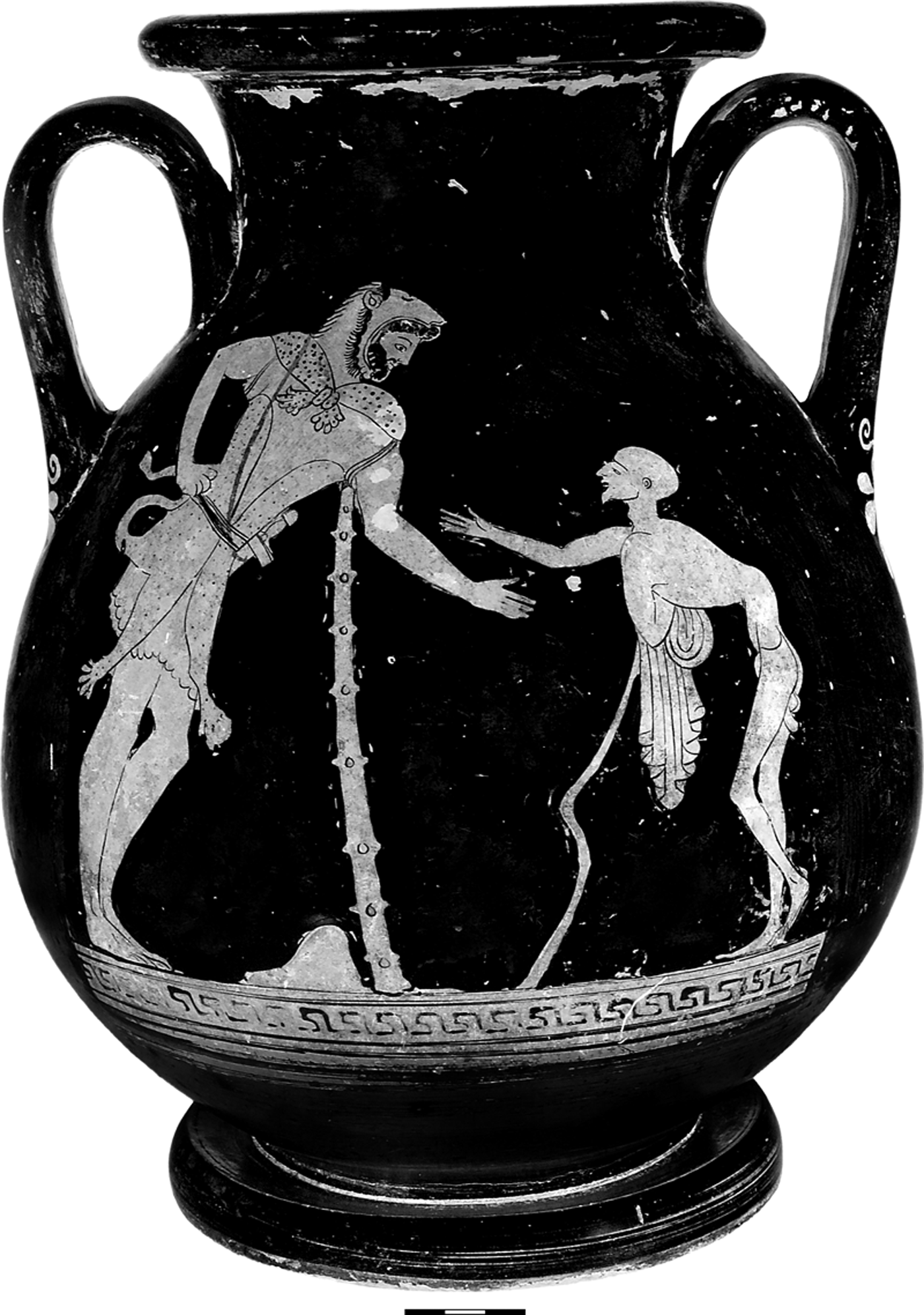 OBESITY, CORPULENCE AND EMACIATION IN ROMAN ART1 | Papers of the ...