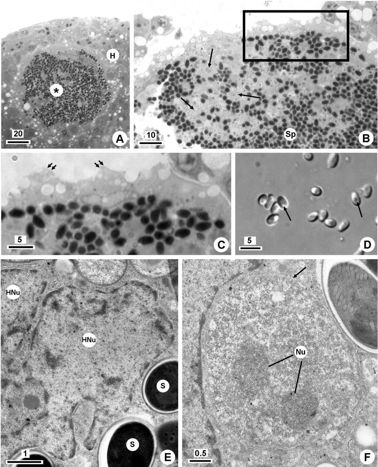 Ultrastructural and molecular studies of Microgemma carolinus n. sp ...