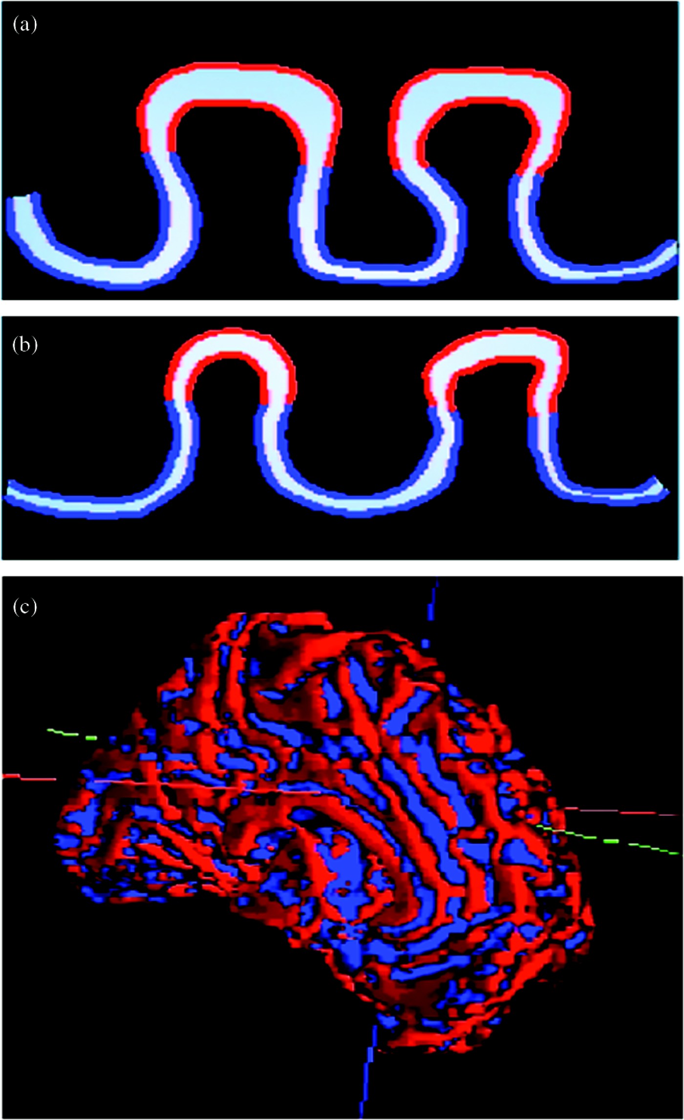 Gyrification and neural connectivity in schizophrenia | Development and ...