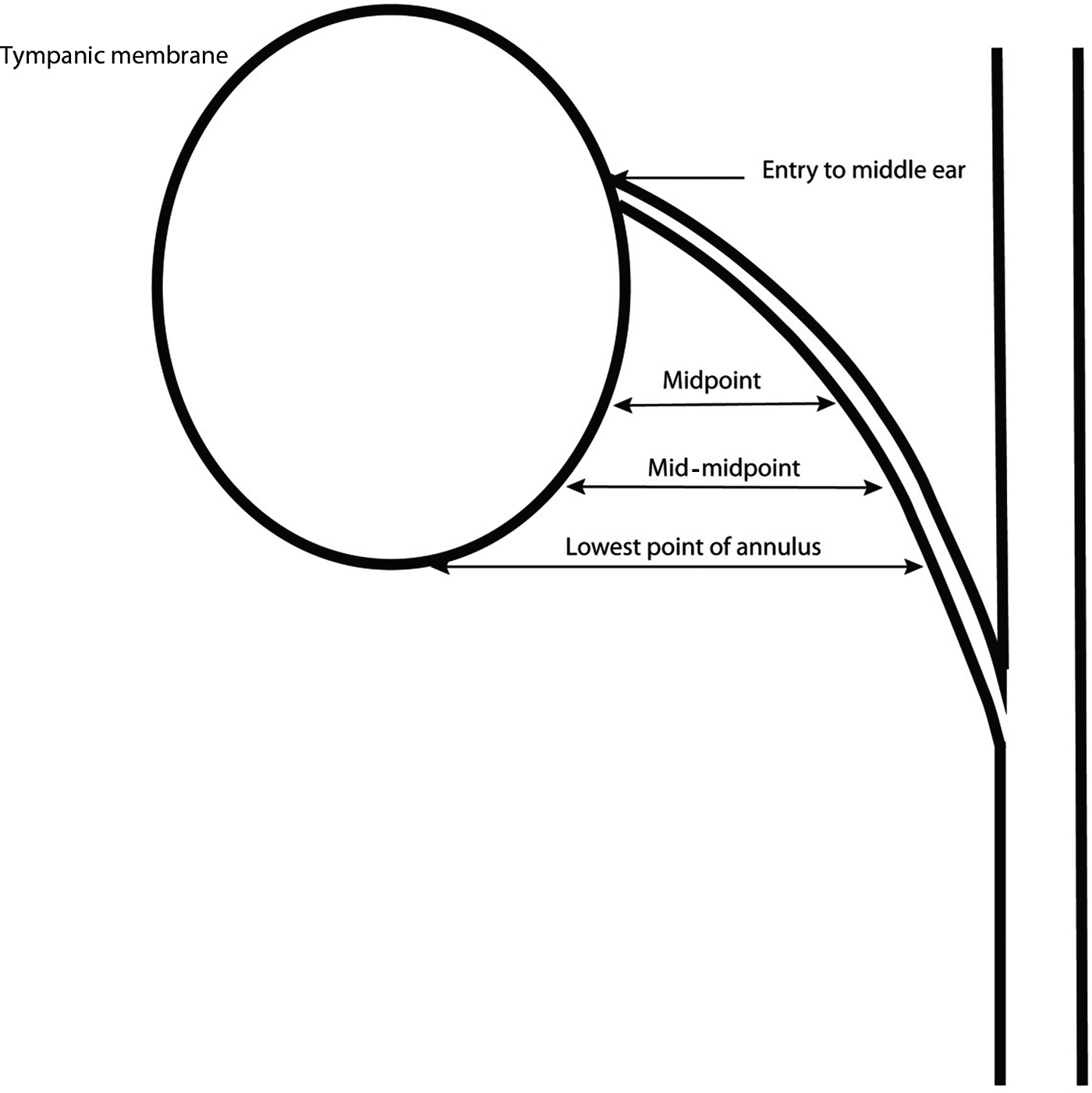 Subannular tube insertion: anatomical considerations | The Journal of ...