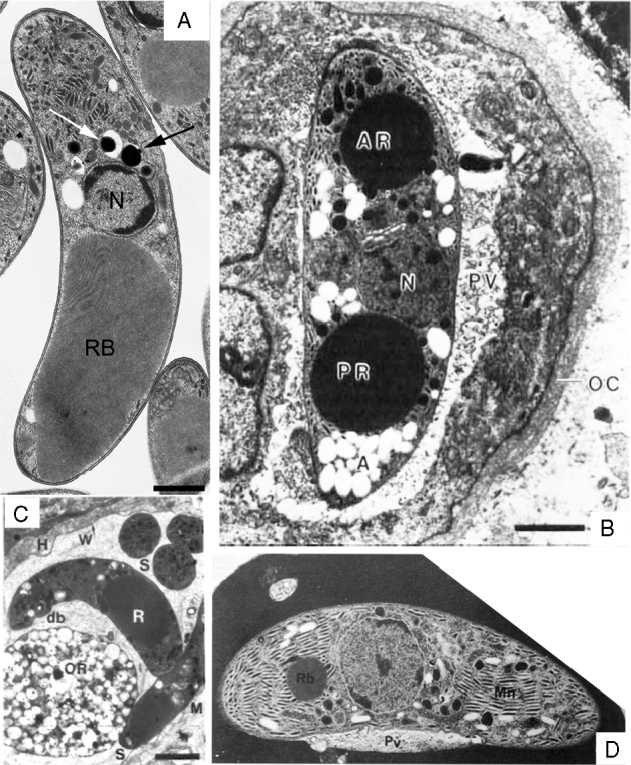Crystalloid body, refractile body and virus-like particles in ...