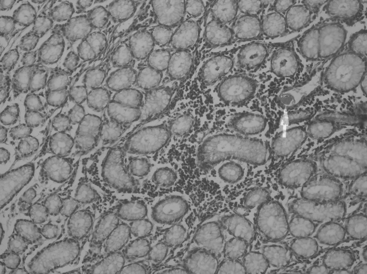 Pathophysiology of Marshallagia marshalli in experimentally infected ...