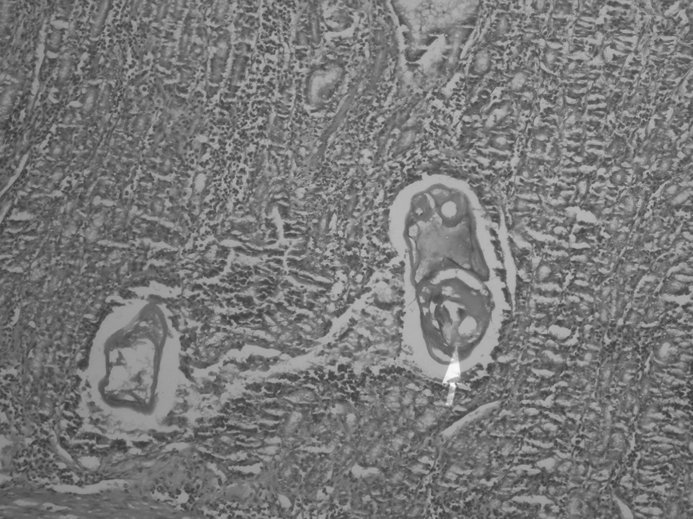 Pathophysiology of Marshallagia marshalli in experimentally infected ...