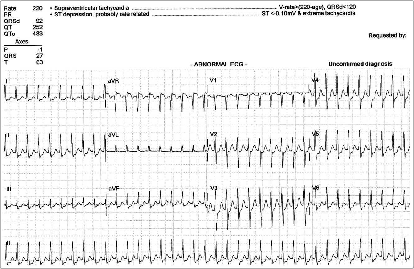 Prehospital Synchronized Electrical Cardioversion of a Poorly Perfused ...