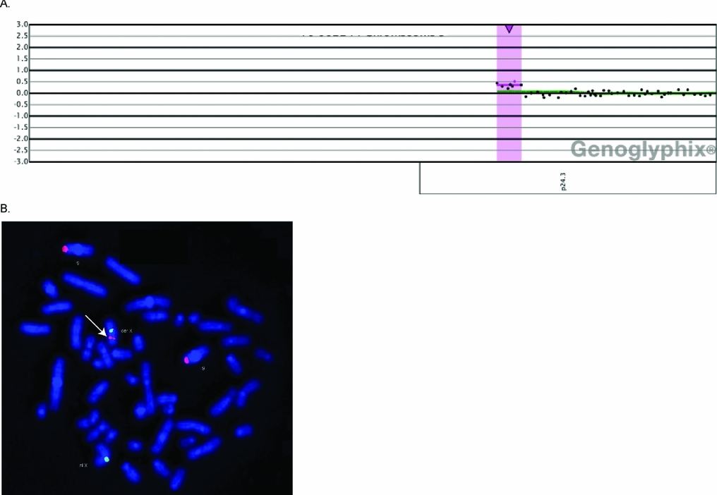 CHROMOSOMAL MICROARRAYS: THE BENEFITS AND CHALLENGES OF INTRODUCTION ...