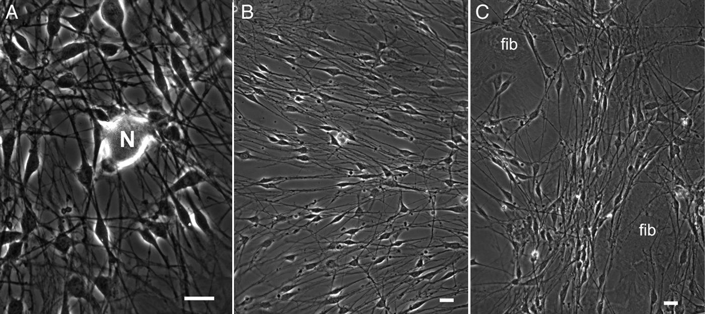 Phenotypic changes in satellite glial cells in cultured trigeminal ...
