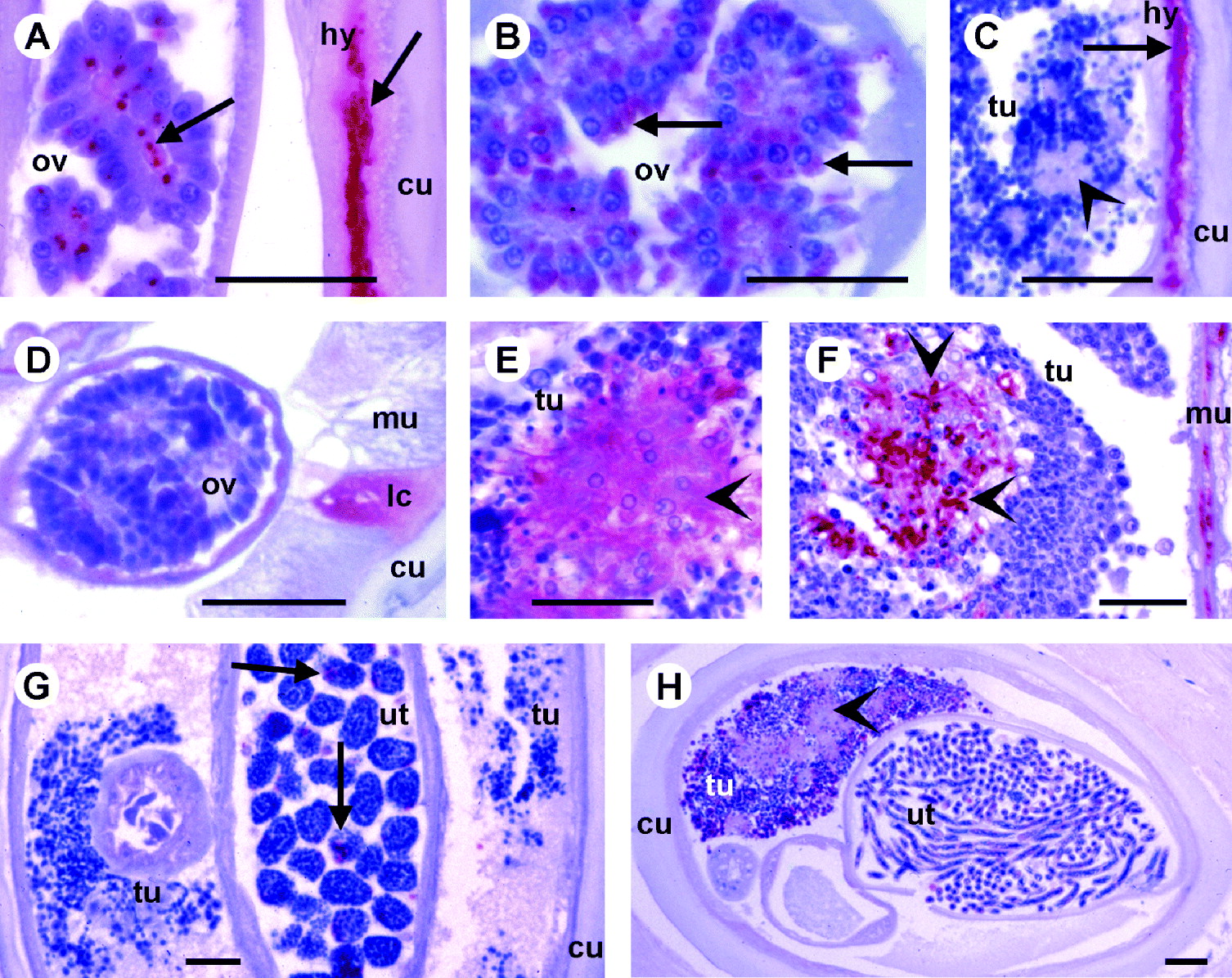 Immunohistological studies on neoplasms of female and male Onchocerca ...