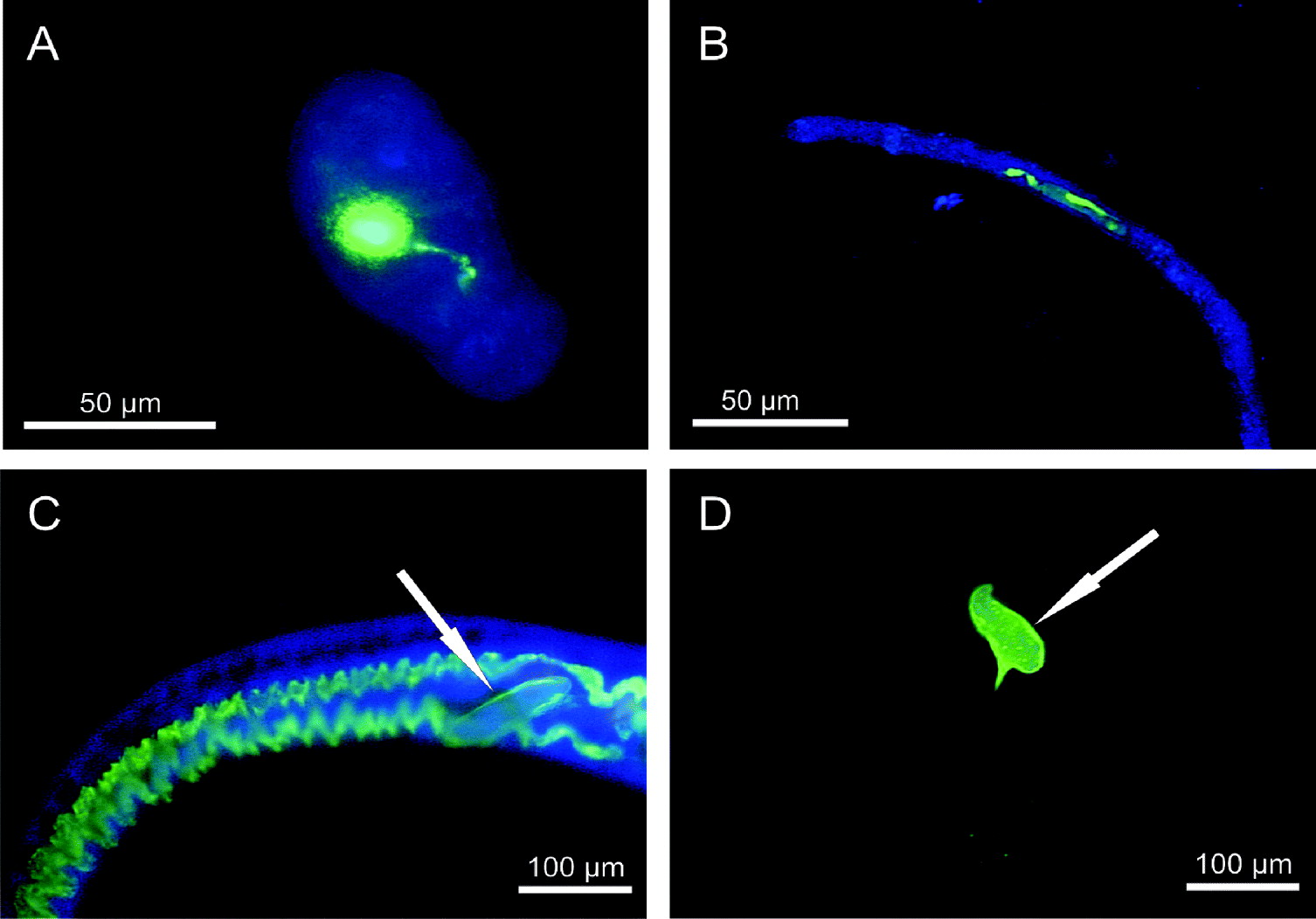 Schistosomula, pre-adults and adults of Schistosoma mansoni ingest ...