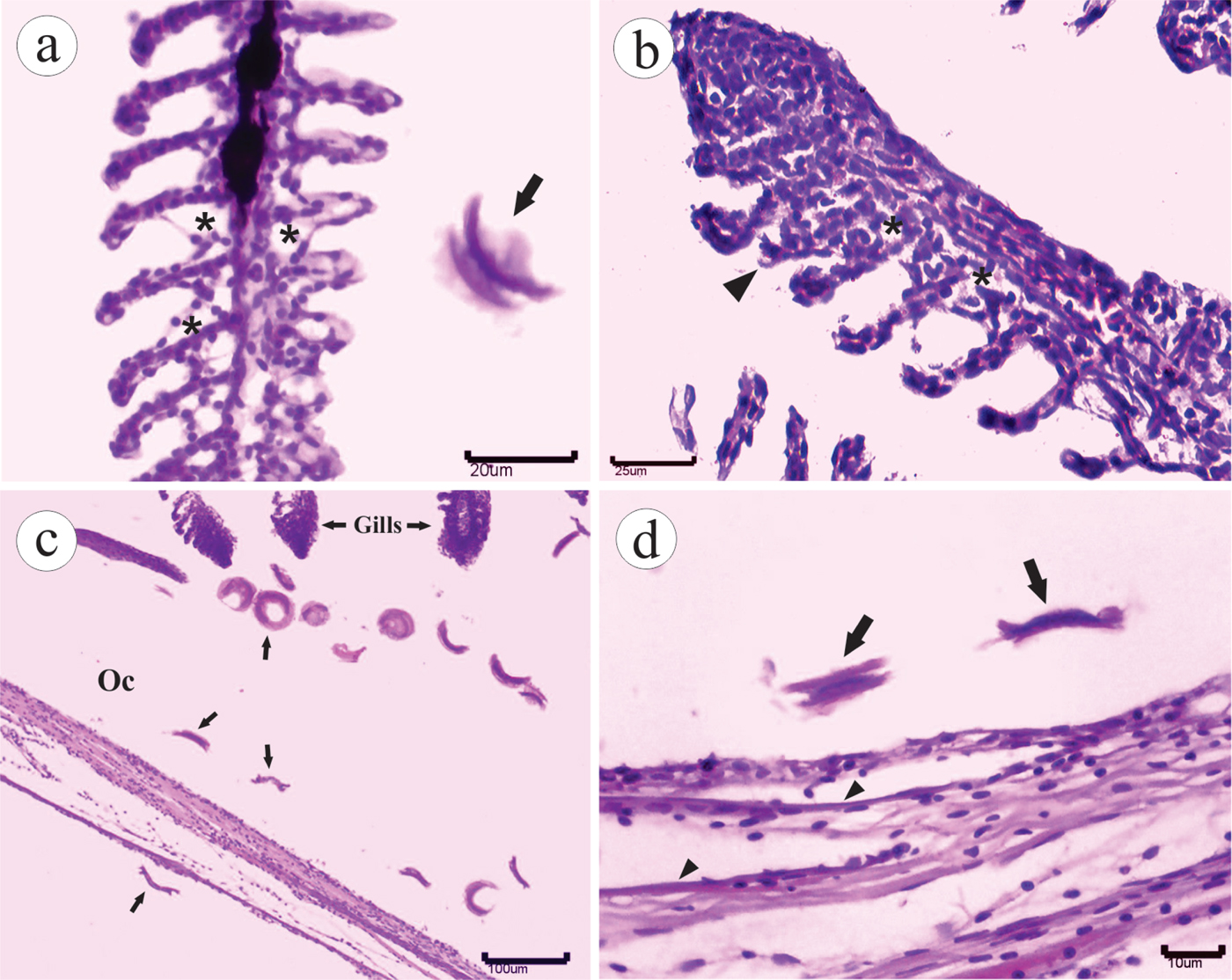 Trichodina heterodentata (Ciliophora) infestation on Prochilodus ...