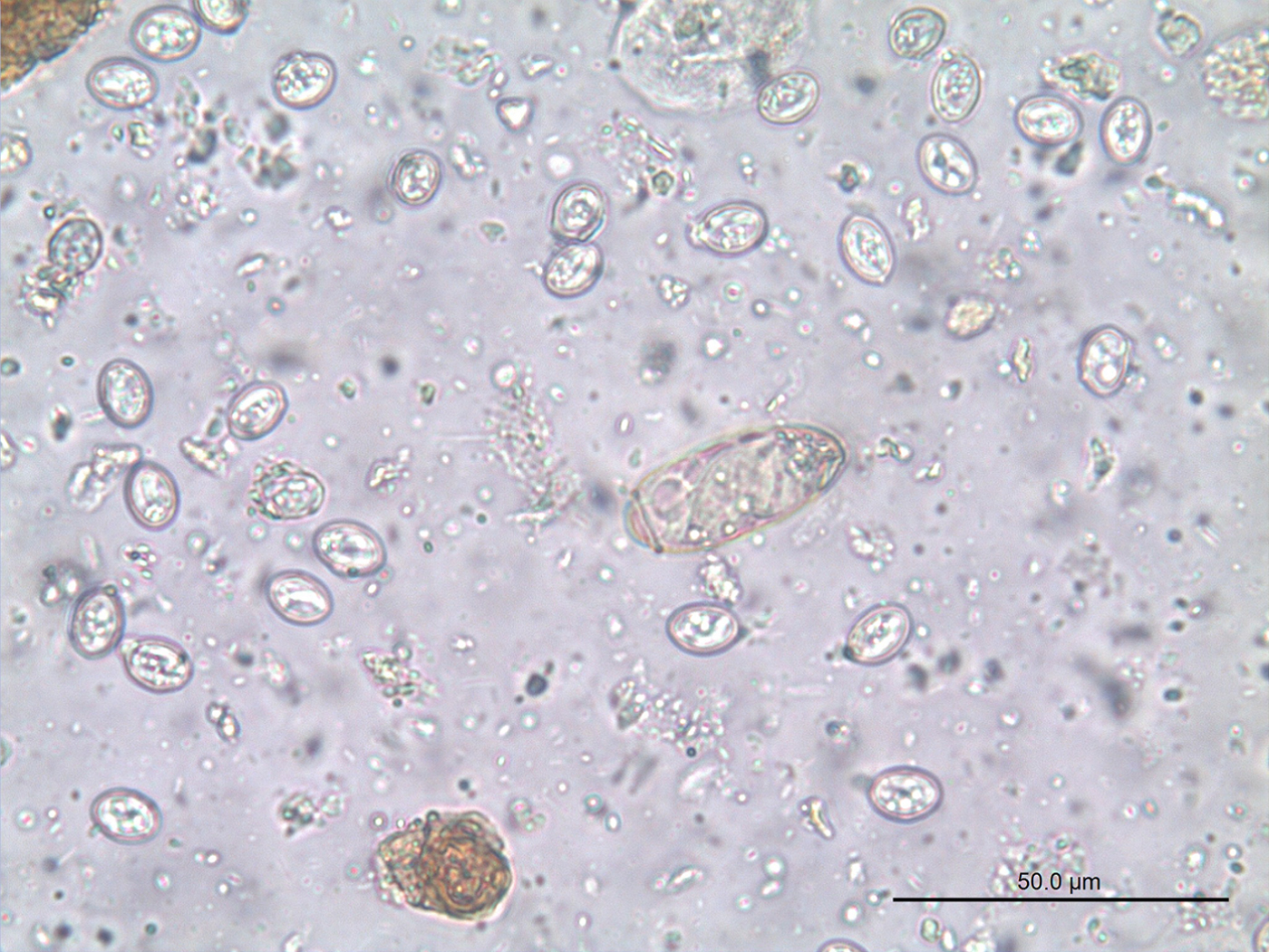 Molecular identification of Sarcocystis spp. helped to define the ...